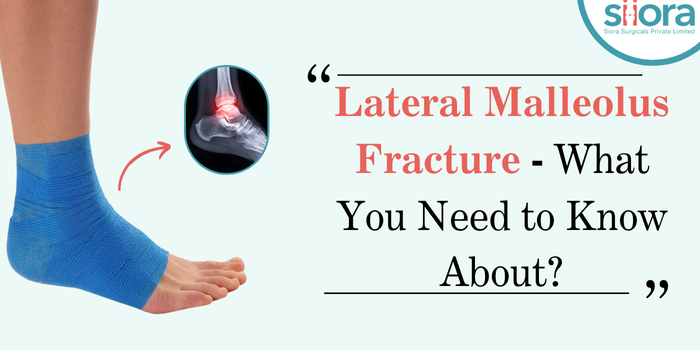 Lateral Malleolus Swelling